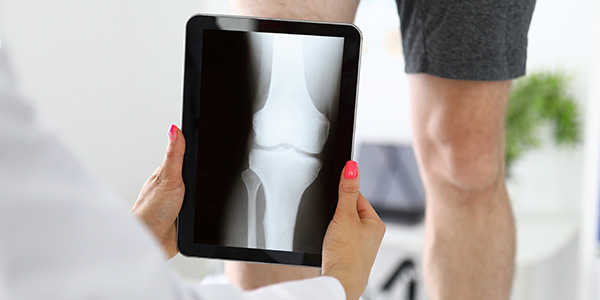 Opérations et Chirurgies du genou : Zoom sur les Ligaments Croisés ...